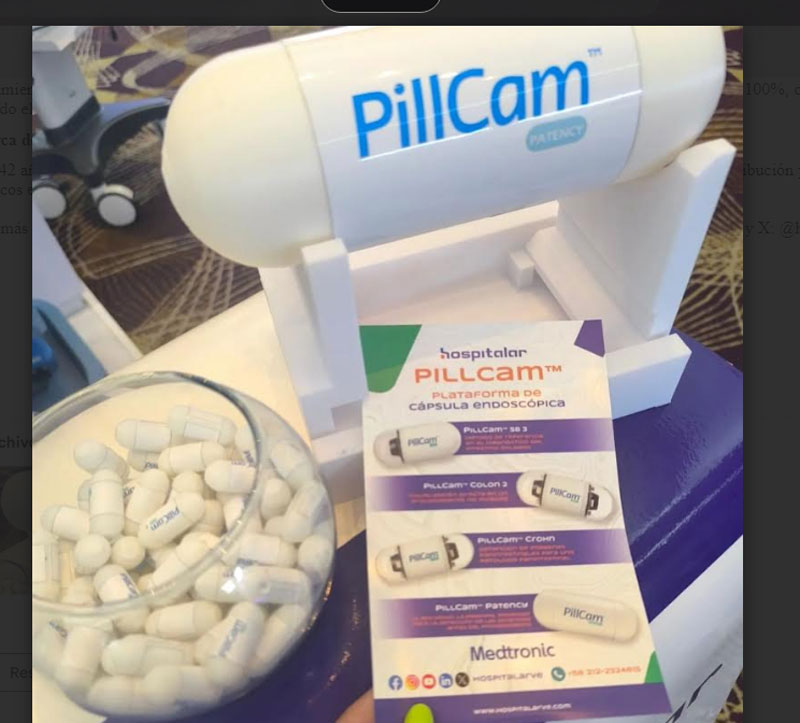 PillCam: La cápsula endoscópica para diagnósticos acertados en el ...
